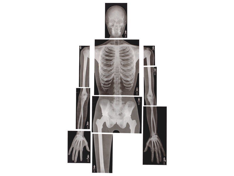 RADIOGRAPHIES Le corps humain - Kadolog